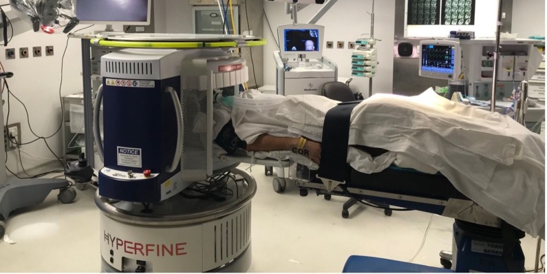 First intraoperative MRI in Pakistan conducted at Aga Khan University ...